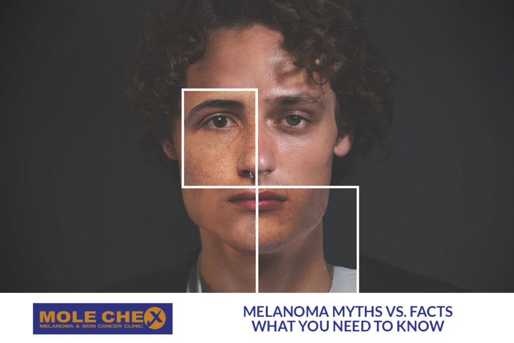 Melanoma Myths vs. Facts: What You Need to Know - MoleChex - Skin ...