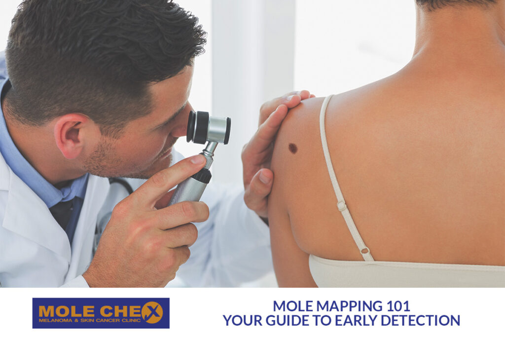 Mole Mapping 101: Your Guide to Early Detection of Skin Cancer - MoleChex - Skin Cancer and ...