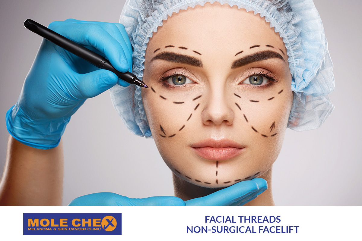 Facial Threads: Non-Surgical Facelift Solutions - MoleChex - Skin ...