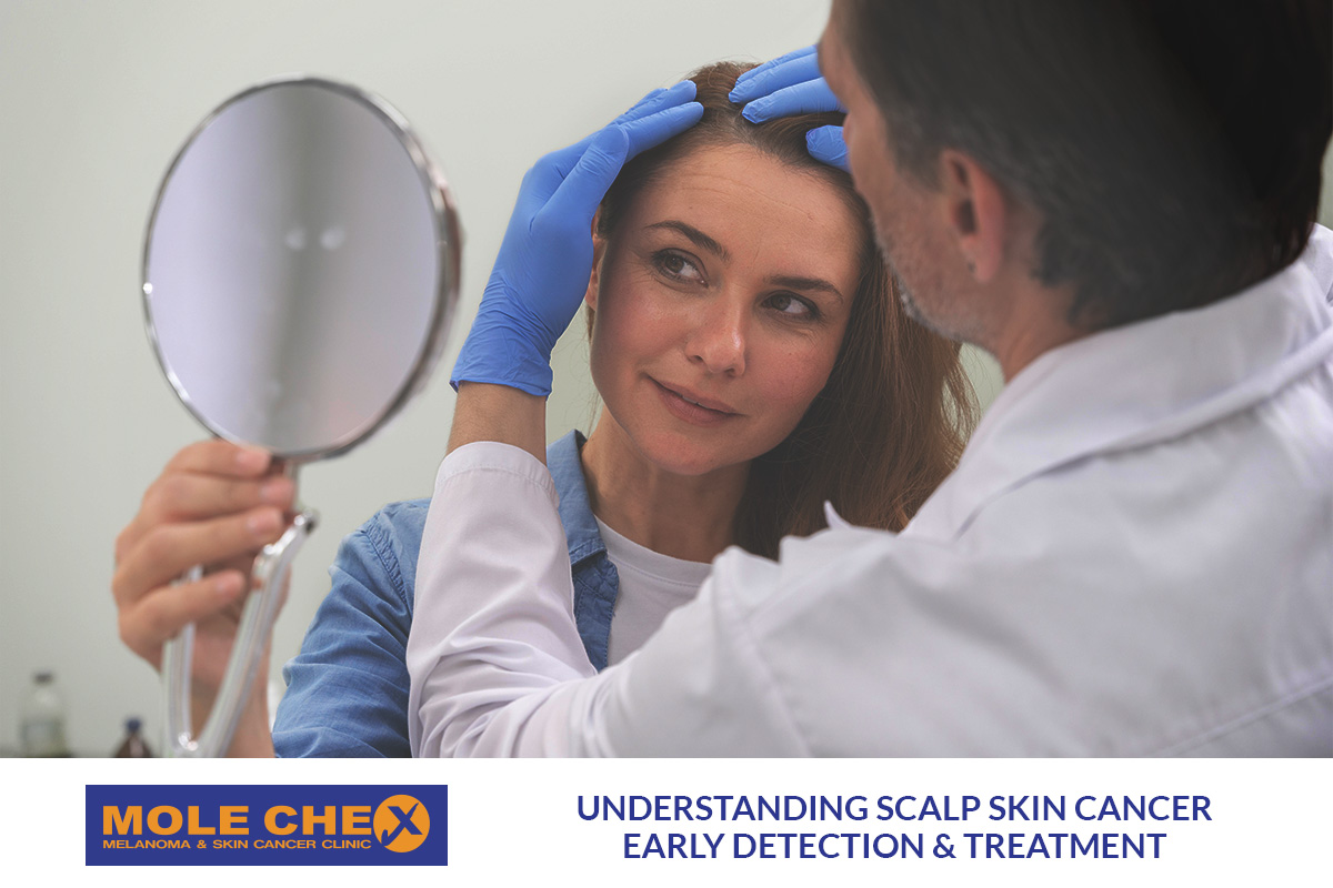 Understanding Scalp Skin Cancer: Early Detection & Treatments - MoleChex - Skin Cancer and ...
