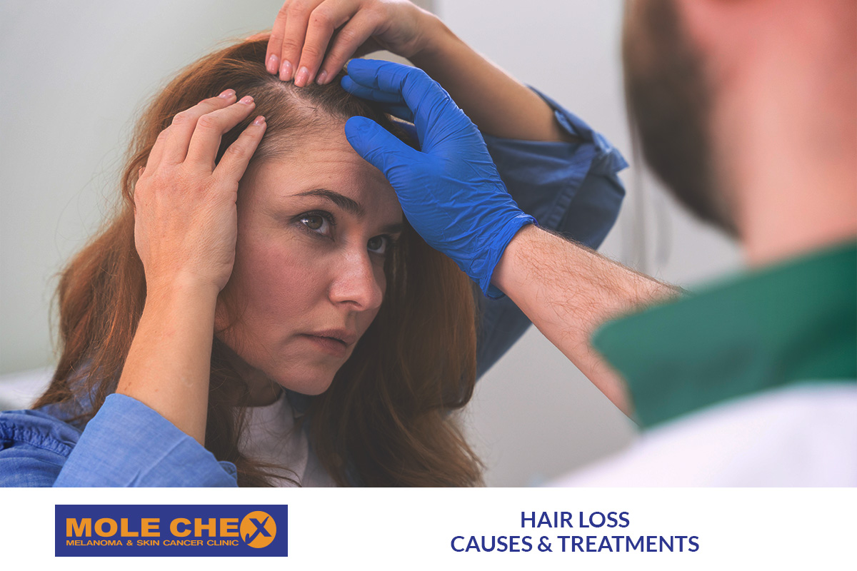 Hair Loss: Causes & Treatments - MoleChex - Skin Cancer and Melanoma Clinic